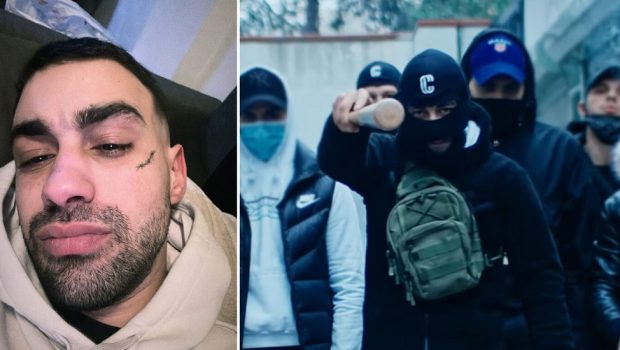 Θεσσαλονίκη: Ψάχνουν τον τράπερ Ricta που χτύπησε τον 23χρονο - Ο φίλος ...